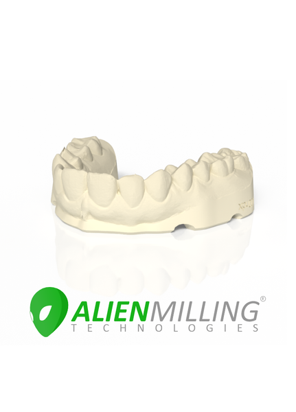 Alien 3D Printed Dental Models – Alien Milling Technologies